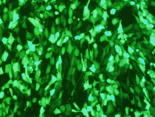 3T3-L1 Transfection Reagent - Avalanche® Adipocyte Kit