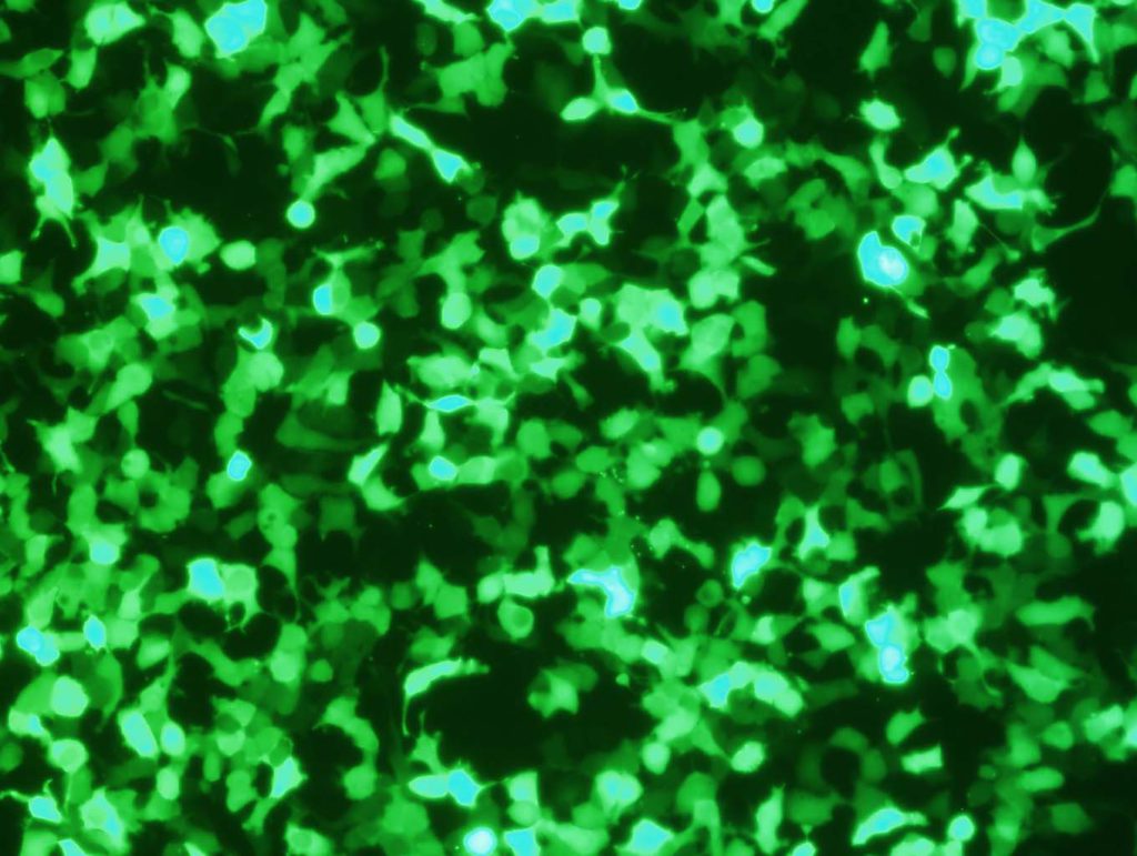 786-O Transfection Reagent - Avalanche® Kidney Cancer Kit