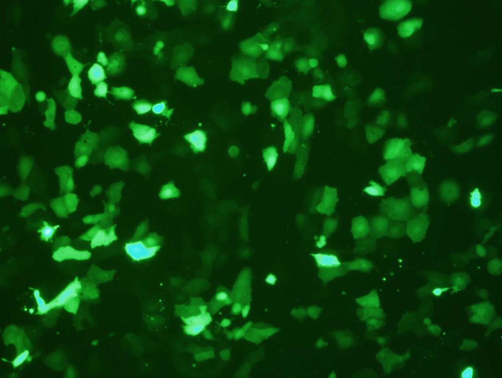 LNCaP Prostate Cancer Transfection Reagent - Avalanche® Kit