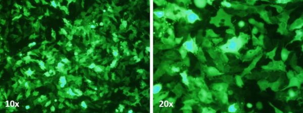 MDA-MB-468 Breast Cancer Transfection - Avalanche® Kit