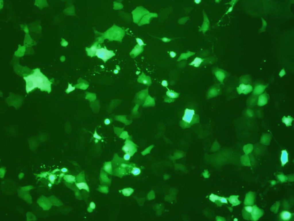 PC-3 Prostate Cancer Transfection Reagent - Avalanche® Kit