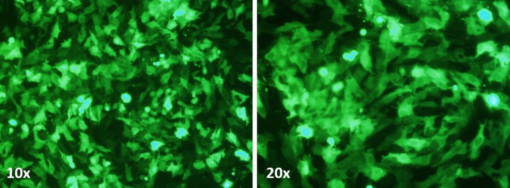 ZR-75-1 Breast Cancer Cell Transfection Reagent - Avalanche®